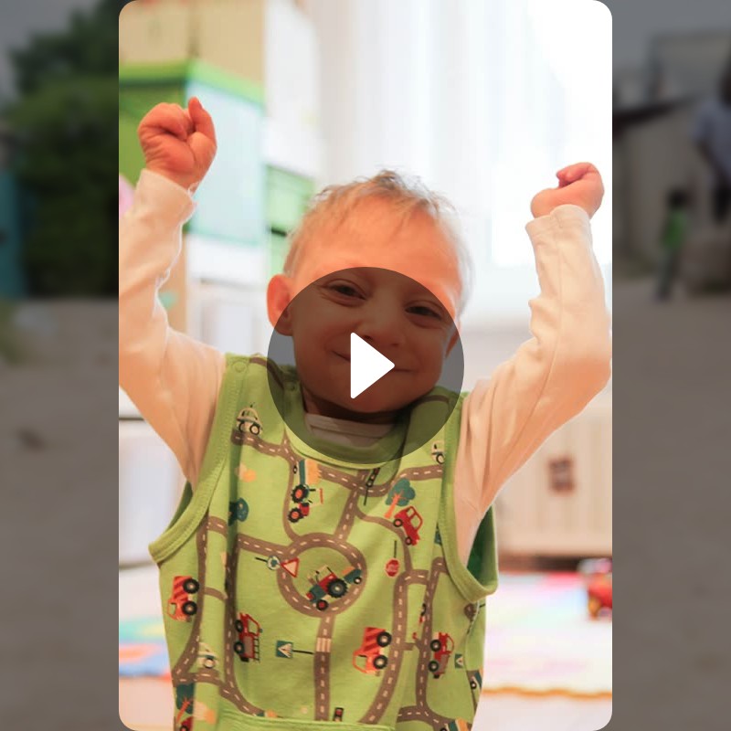 Our Son Is Five Years Old - And Only 31" Tall - Born Different | Snapchat