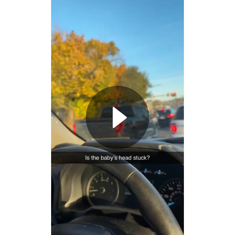 Is the baby’s head stuck? | Spotlight on Snapchat