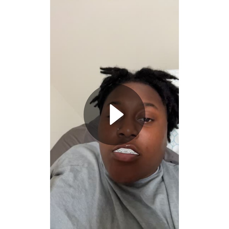 a2dmr | Spotlight on Snapchat