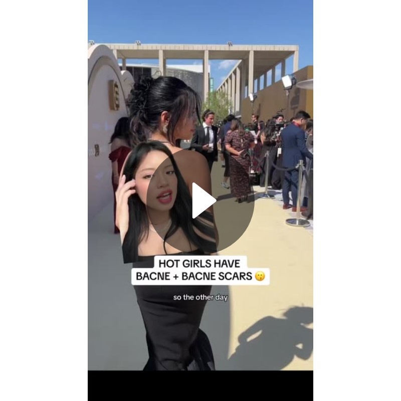 Vi Luong's Honest Back Scar Reveal at Red Carpet Event | Video by Vi ...