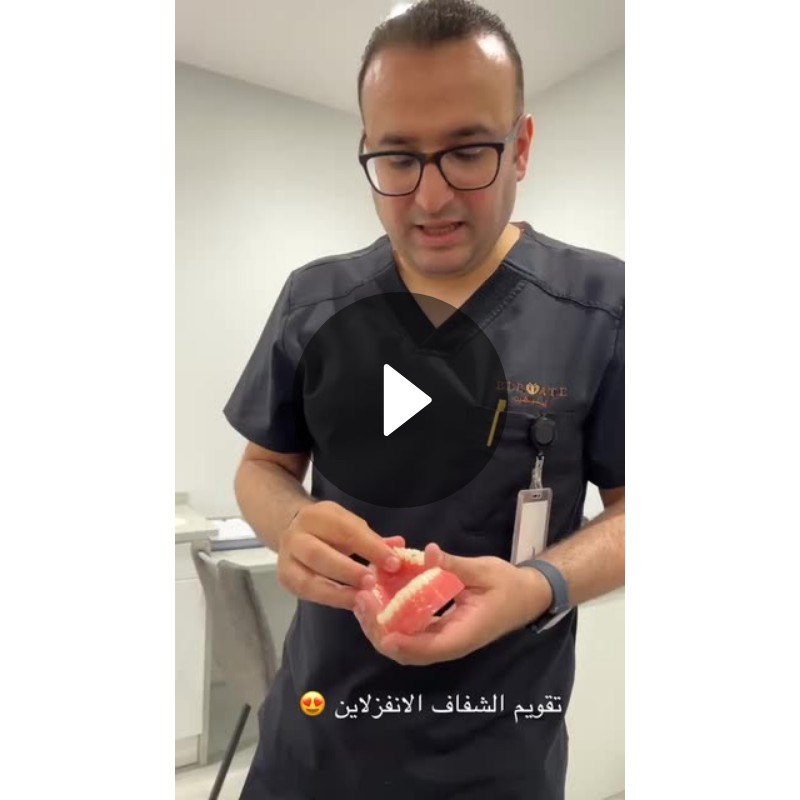 تقويم الشفاف الانفزلاين 😍 | Spotlight on Snapchat