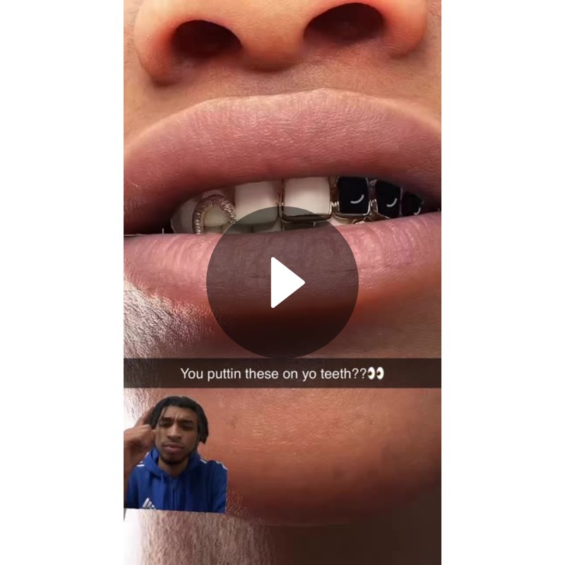You puttin these on yo teeth??👀 | Spotlight on Snapchat