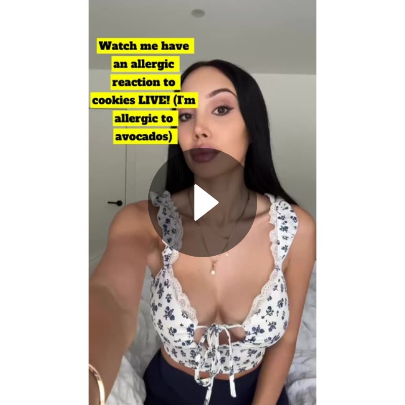 Watch me have an allergic reaction to cookies LIVE! (I’m allergic to avocados) | Spotlight on ...