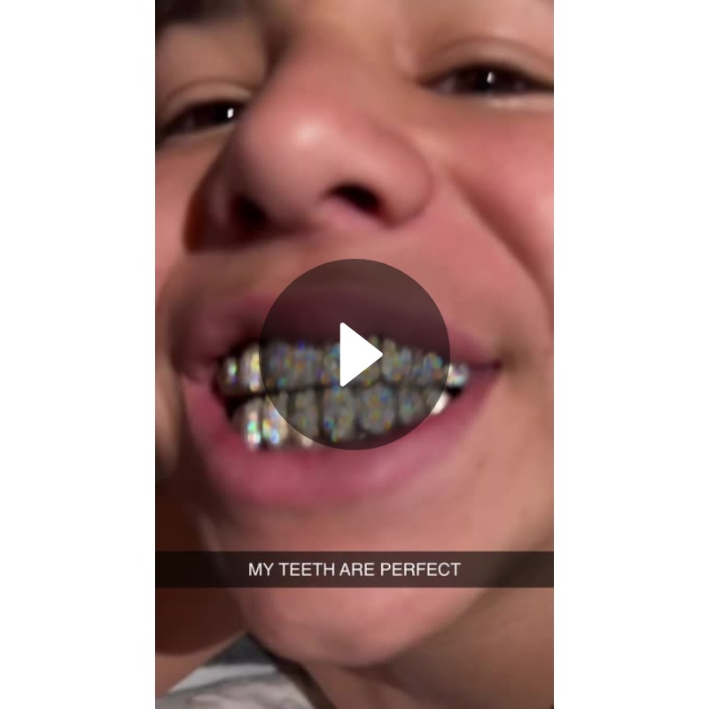 MY TEETH ARE PERFECT | Spotlight on Snapchat