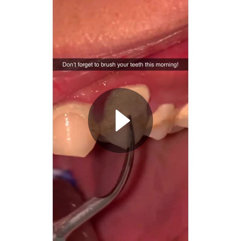 Don’t forget to brush your teeth this morning! | Spotlight on Snapchat