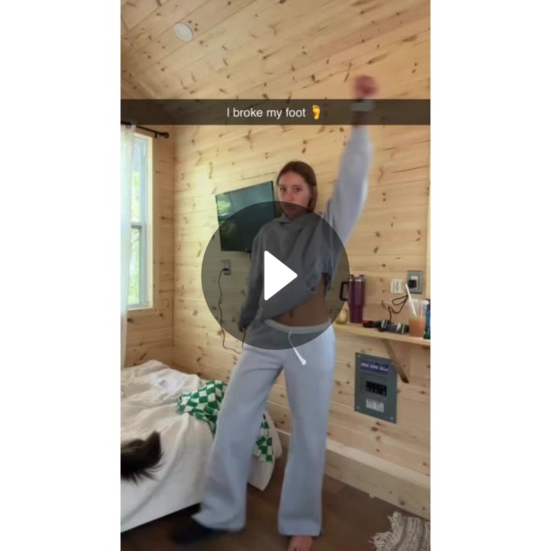 I broke my foot 🦶 | Spotlight on Snapchat