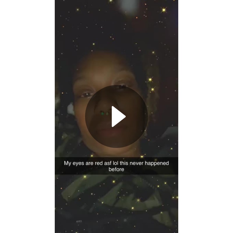 My eyes are red asf lol this never happened before | Spotlight on Snapchat