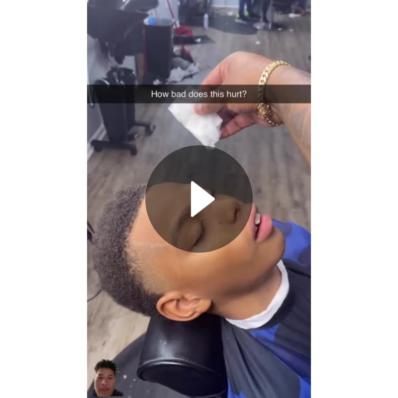 How bad does this hurt? | Spotlight on Snapchat