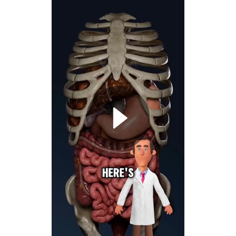 Animated meme featuring food surgery characters. | Dr. Painkill ...