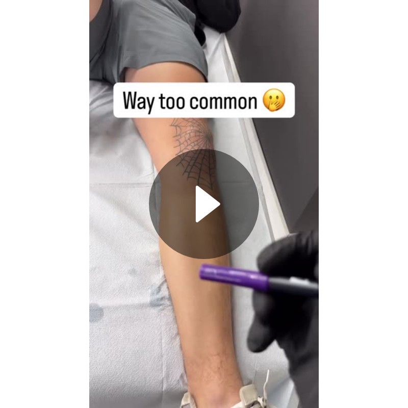 scm_ink2025 | Spotlight on Snapchat